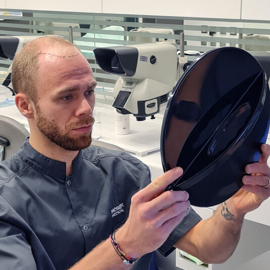 Haartransplantation von Alexander Schlager | Moser Medical